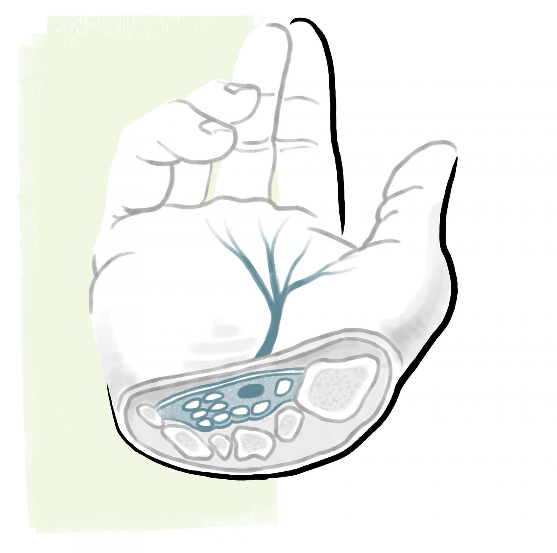Nerve compression syndromes | Advice from hand specialist | rivr.ch